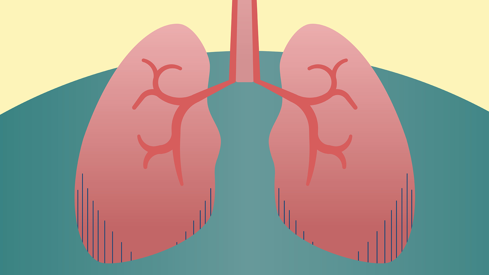 FIBRONEER™ Phase III program initiated | Boehringer Ingelheim