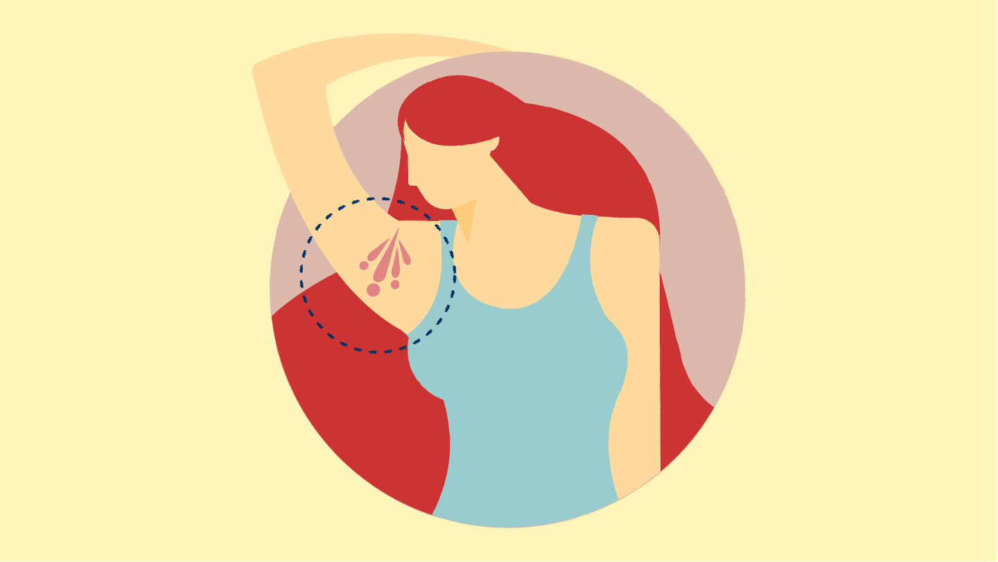 Hidradenitis suppurativa | Boehringer Ingelheim