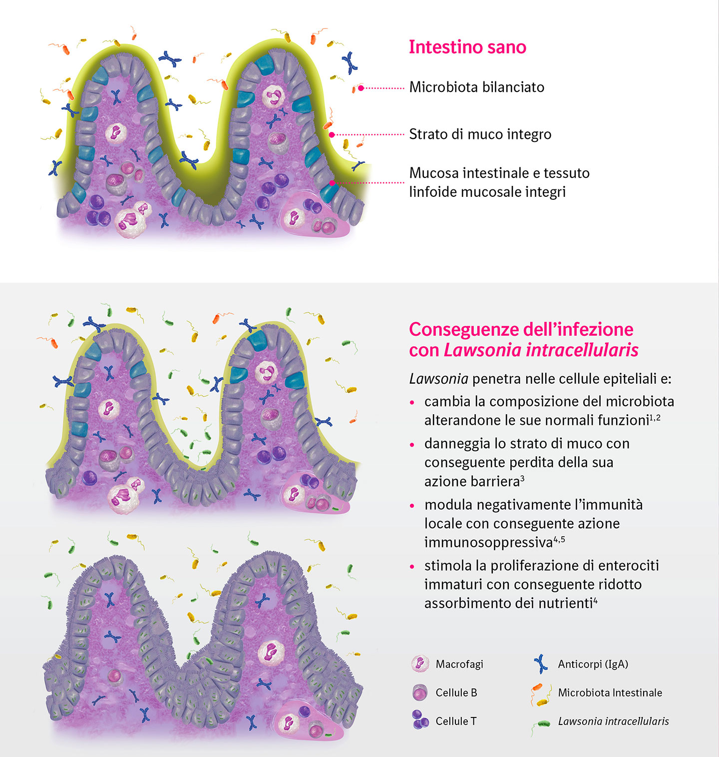 Ileite subclinica: la sapresti riconoscere? | Boehringer Ingelheim