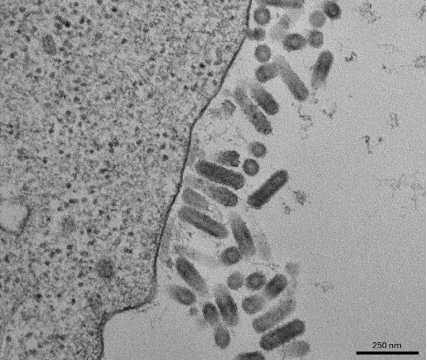 Oncolytic viruses: From the lab to the clinic | Boehringer Ingelheim AT
