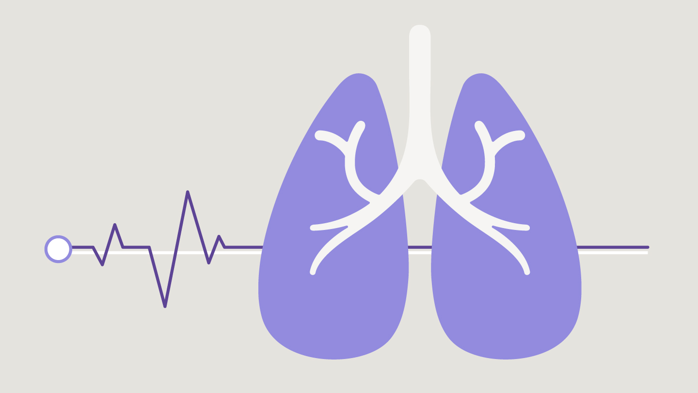 Comprender el cáncer de pulmón microcítico | Boehringer Ingelheim ES