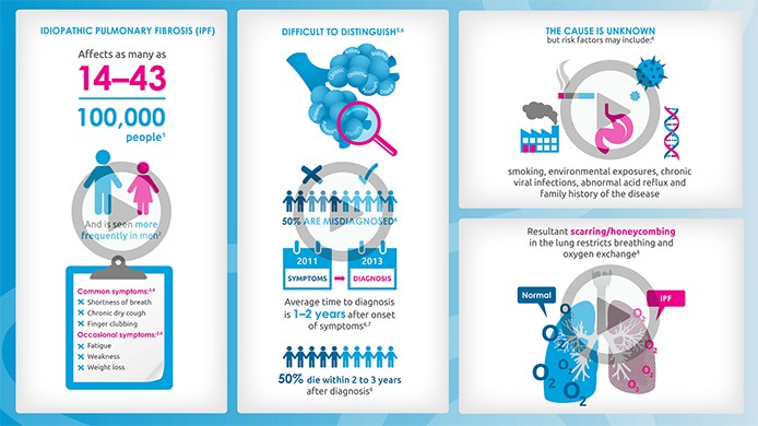 Breathing hope: fighting the lung disease pulmonary fibrosis ...