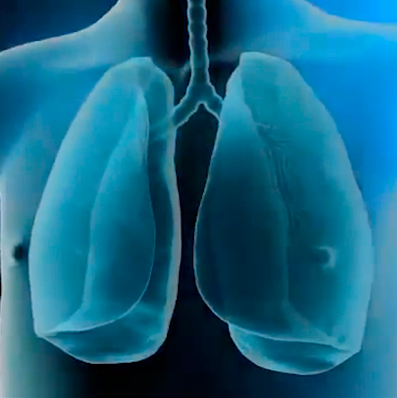 Nerandomilaste da Boehringer atinge endpoint primário no estudo de Fase ...