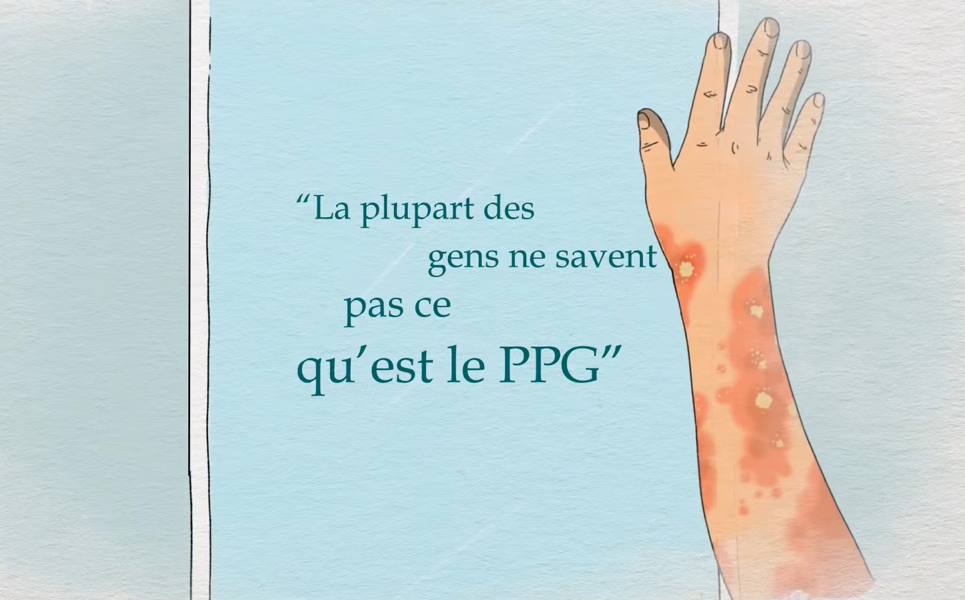 Skin Diseases | Boehringer Ingelheim CH