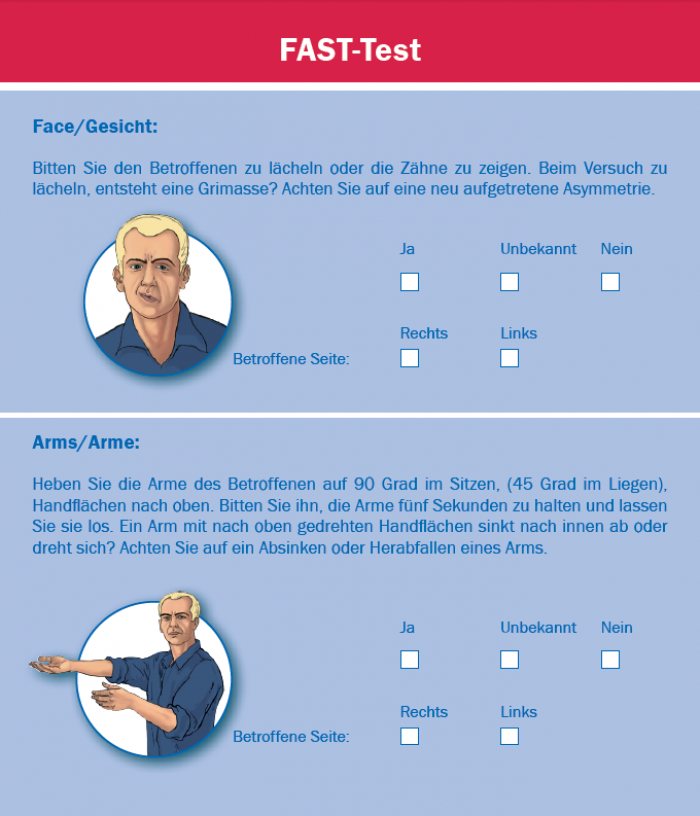 Ischämischer Schlaganfall | Boehringer Ingelheim
