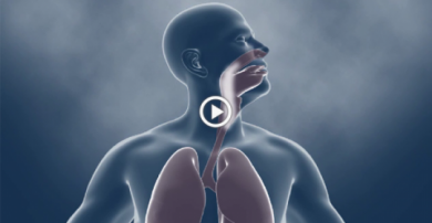 BPCO | Boehringer Ingelheim