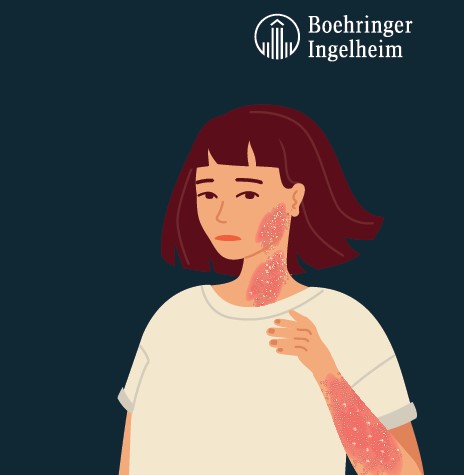 Psoriasis pustuleux généralisé | Boehringer Ingelheim